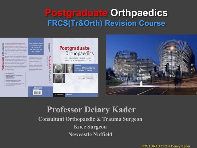 High Tibial Osteotomy and UniKnee for PostGrad Orth FRCS Course | PPTX