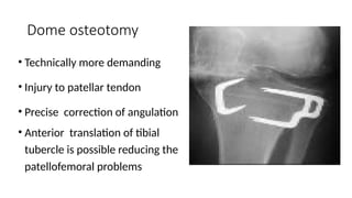 HTO high tibial osteotomy still a role.pptx