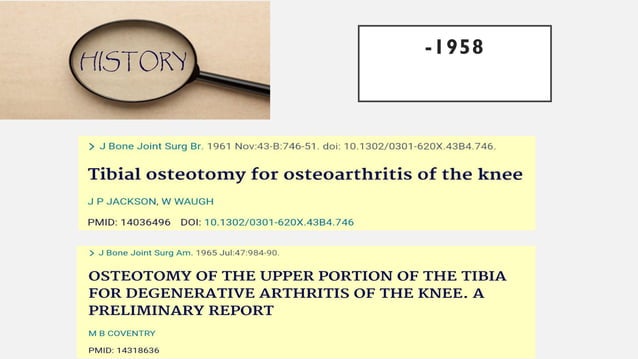 High Tibial Osteotomy is done for treating osteoarthritis confined to ...