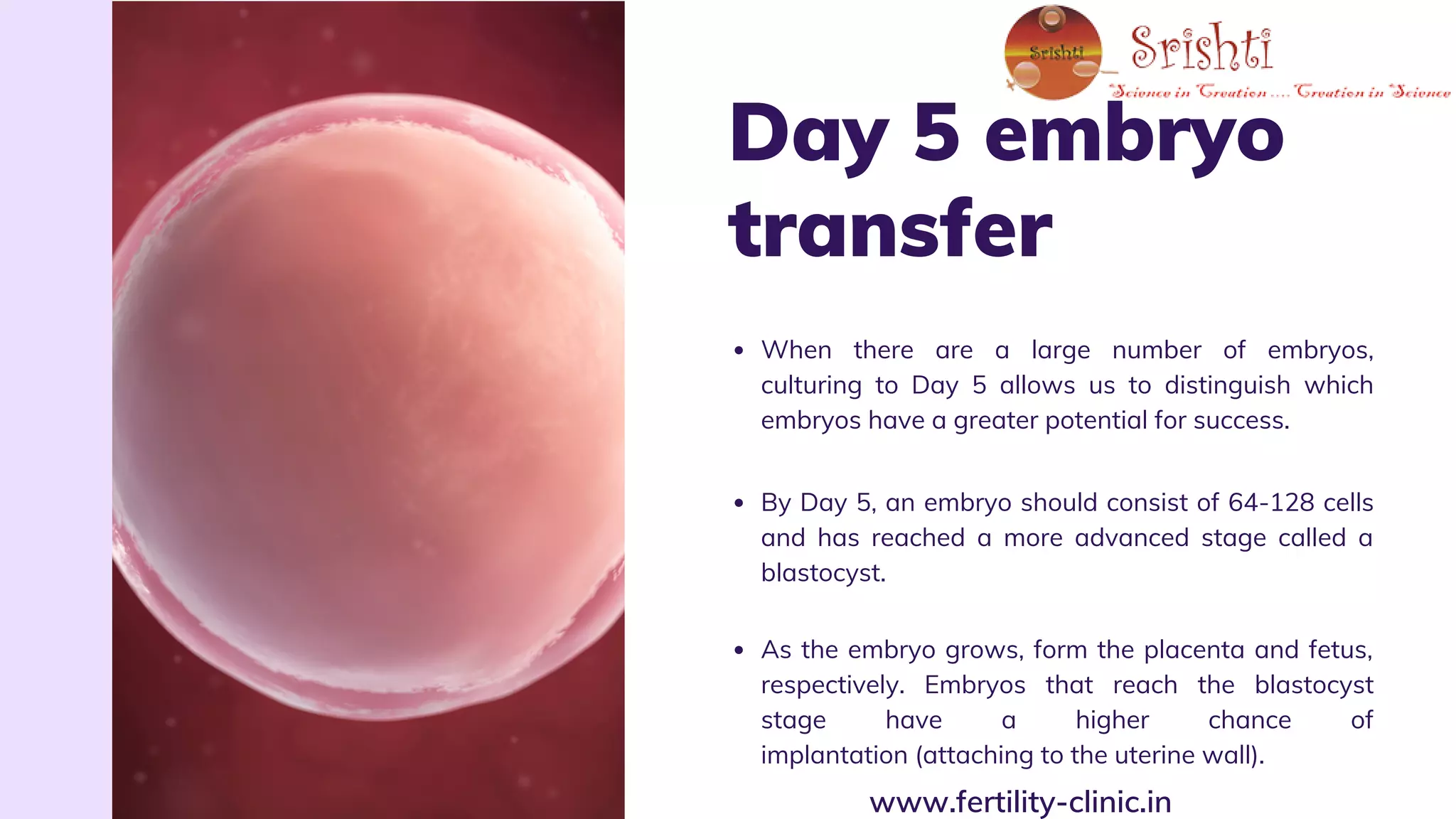 D3 Vs D5 Transfer | Embryo transfer in Tamilnadu | Srishti Hospital ...