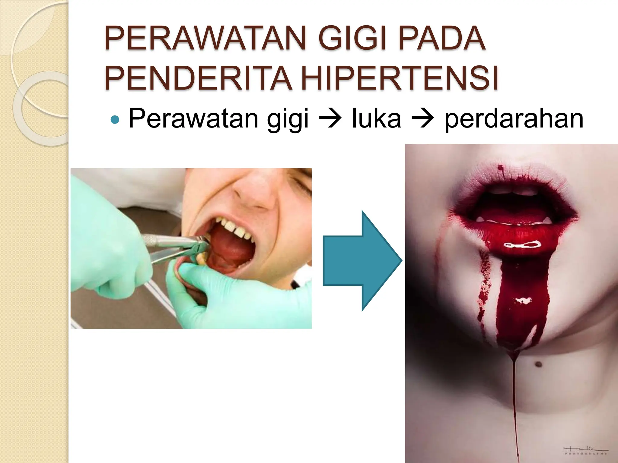 HUBUNGAN KESEHATAN GIGI DAN MULUT DENGAN DARAH TINGGI.pptx