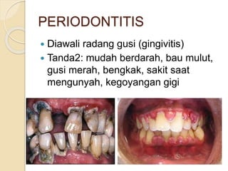 HUBUNGAN KESEHATAN GIGI DAN MULUT DENGAN DARAH TINGGI.pptx