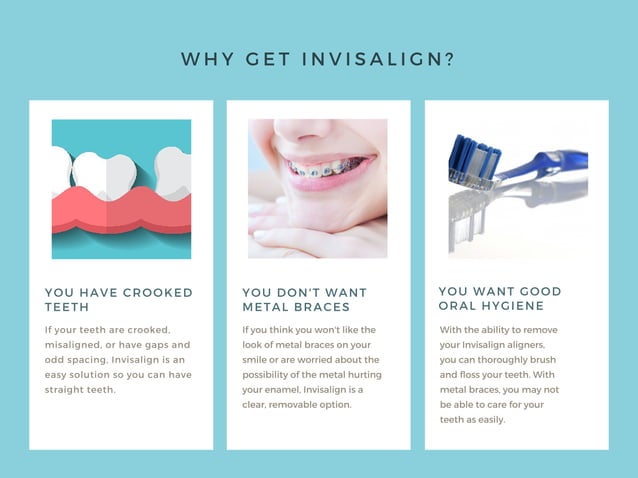 All About Invisalign - What You Need to Know | PDF | Dental Health | Diseases and Conditions