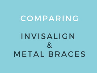 All About Invisalign - What You Need to Know | PDF | Dental Health ...