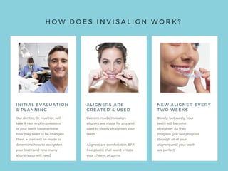 All About Invisalign - What You Need to Know | PDF | Dental Health ...