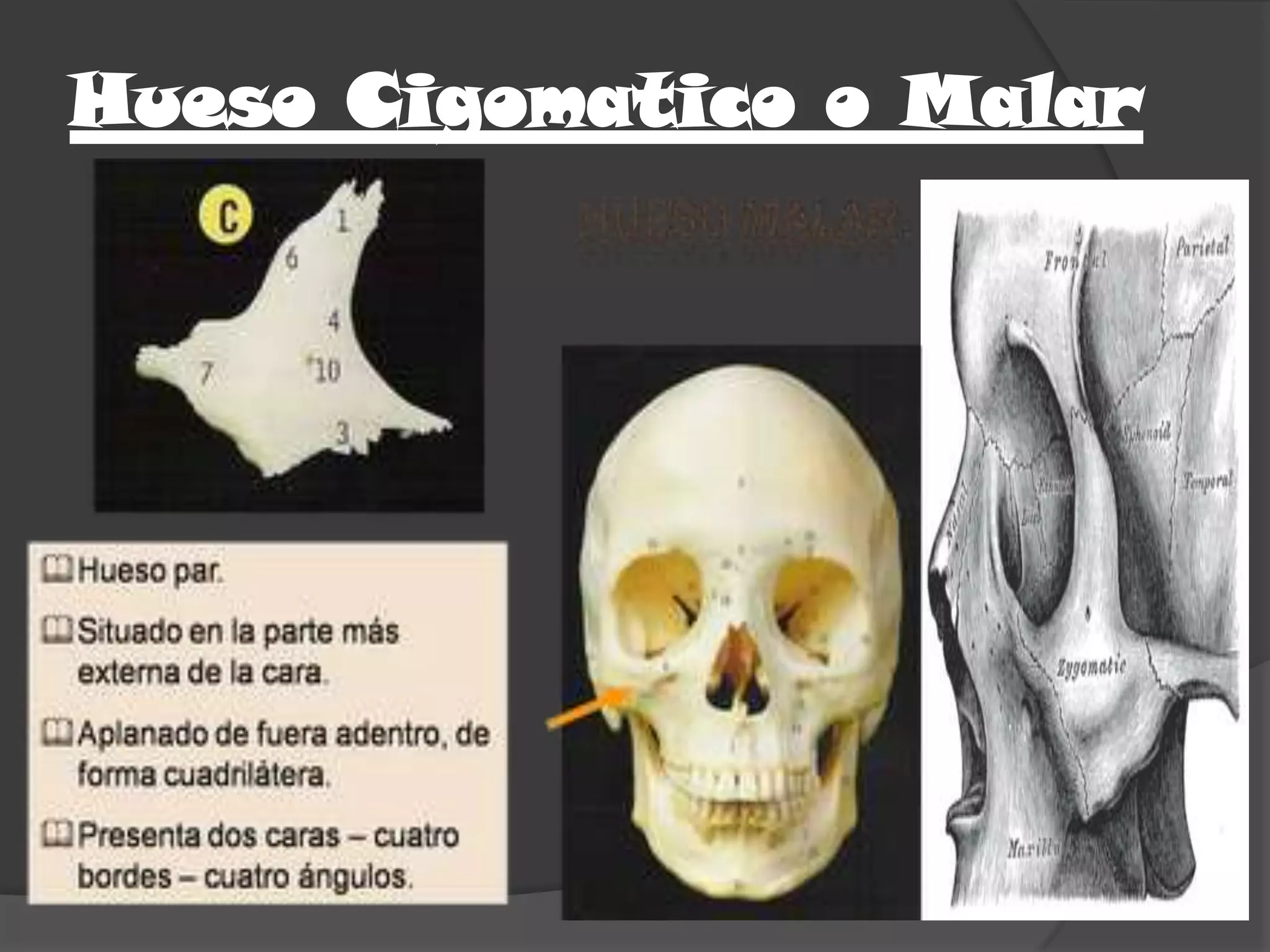 Hueso cigomatico o malar | PPTX