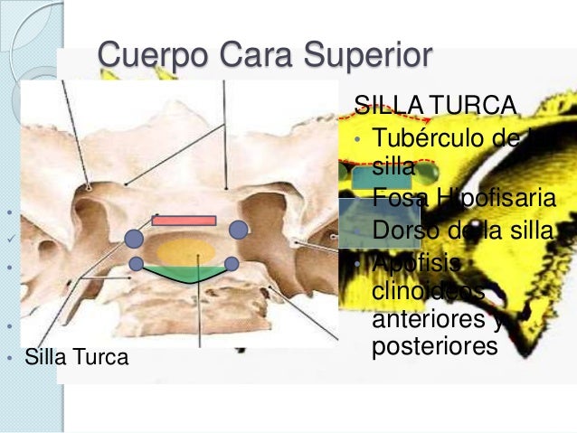 Hueso esfenoides