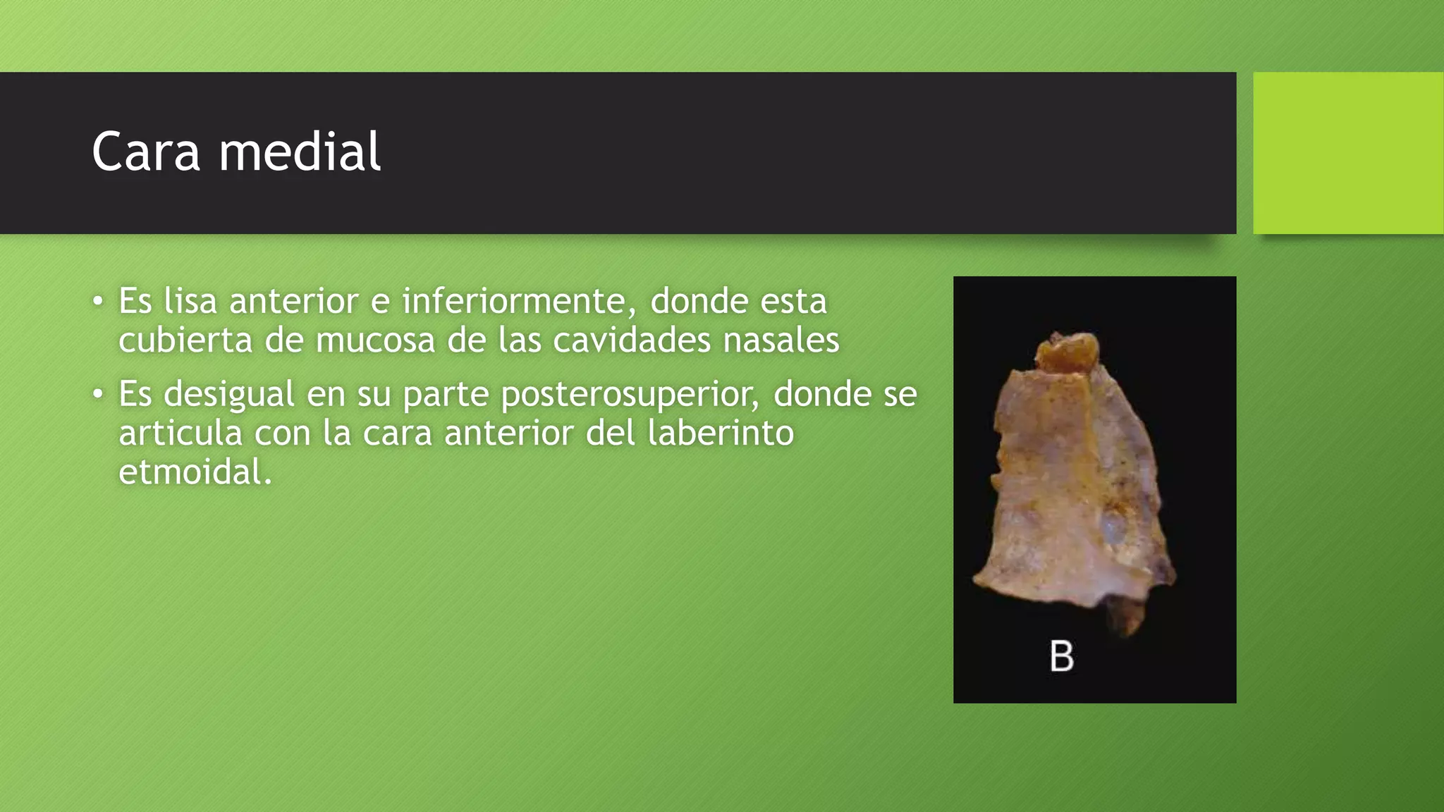 Hueso lagrimal (unguis) | PPTX