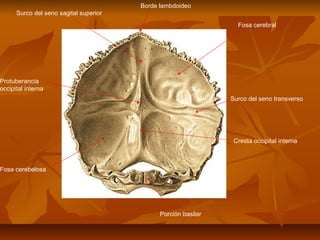 Huesos del craneo | PPT