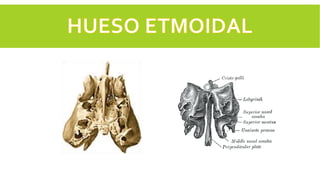 Huesos del Neurocráneo: Frontal y Etmoides | PPTX