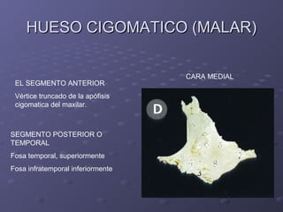 Huesos nasales, cigomatico, mandibula e hioides | PPT