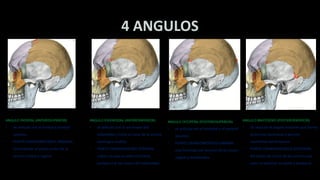 HUESOS PARIETAL Y TEMPORAL de la calota pptx | PPTX