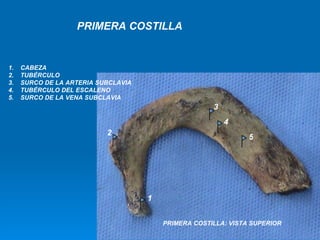 Huesos y articulaciones del tronco | PPT