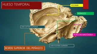 Fosa Mastoidea Cráneo