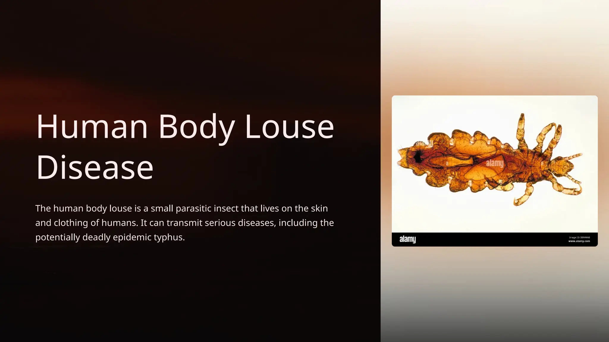 Human-Body-Louse-Disease (1).pptx vector an diseases | PPT