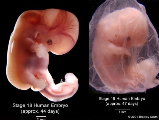 Human Embryo 3 Weeks