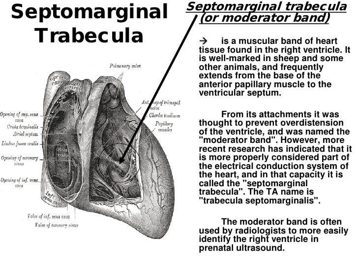 Moderator Band Diagram