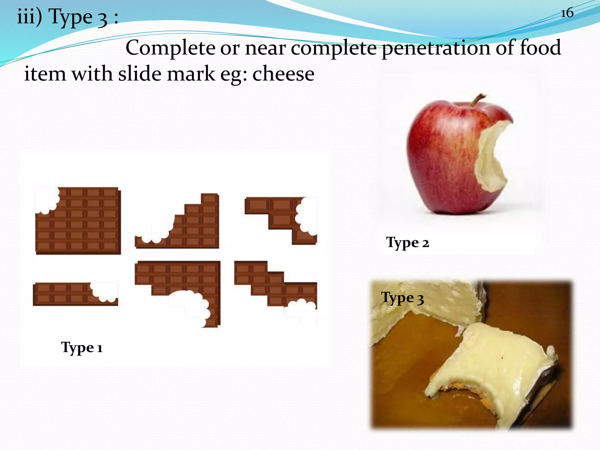Human bite marks | PPTX