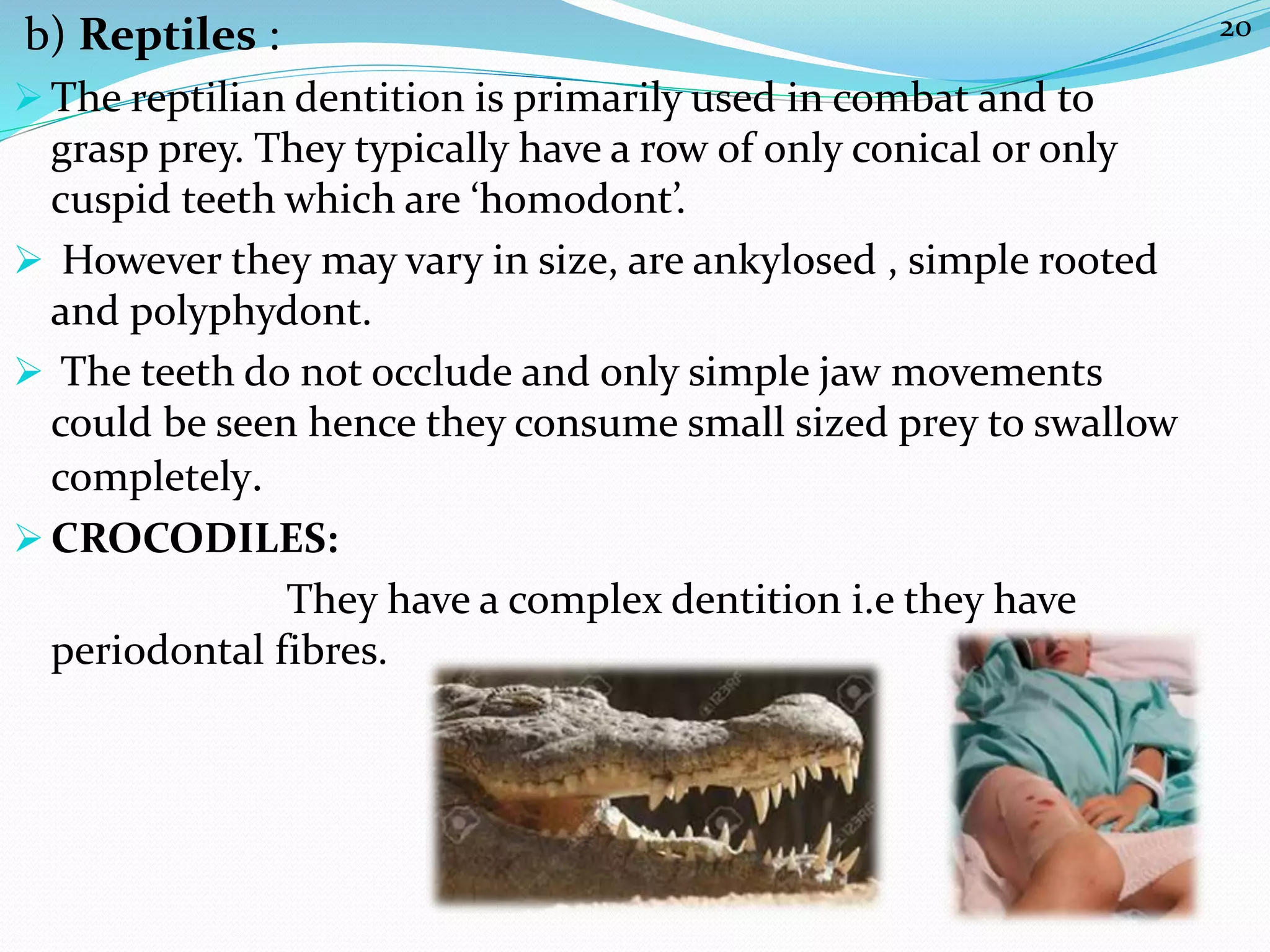 Human bite marks | PPTX