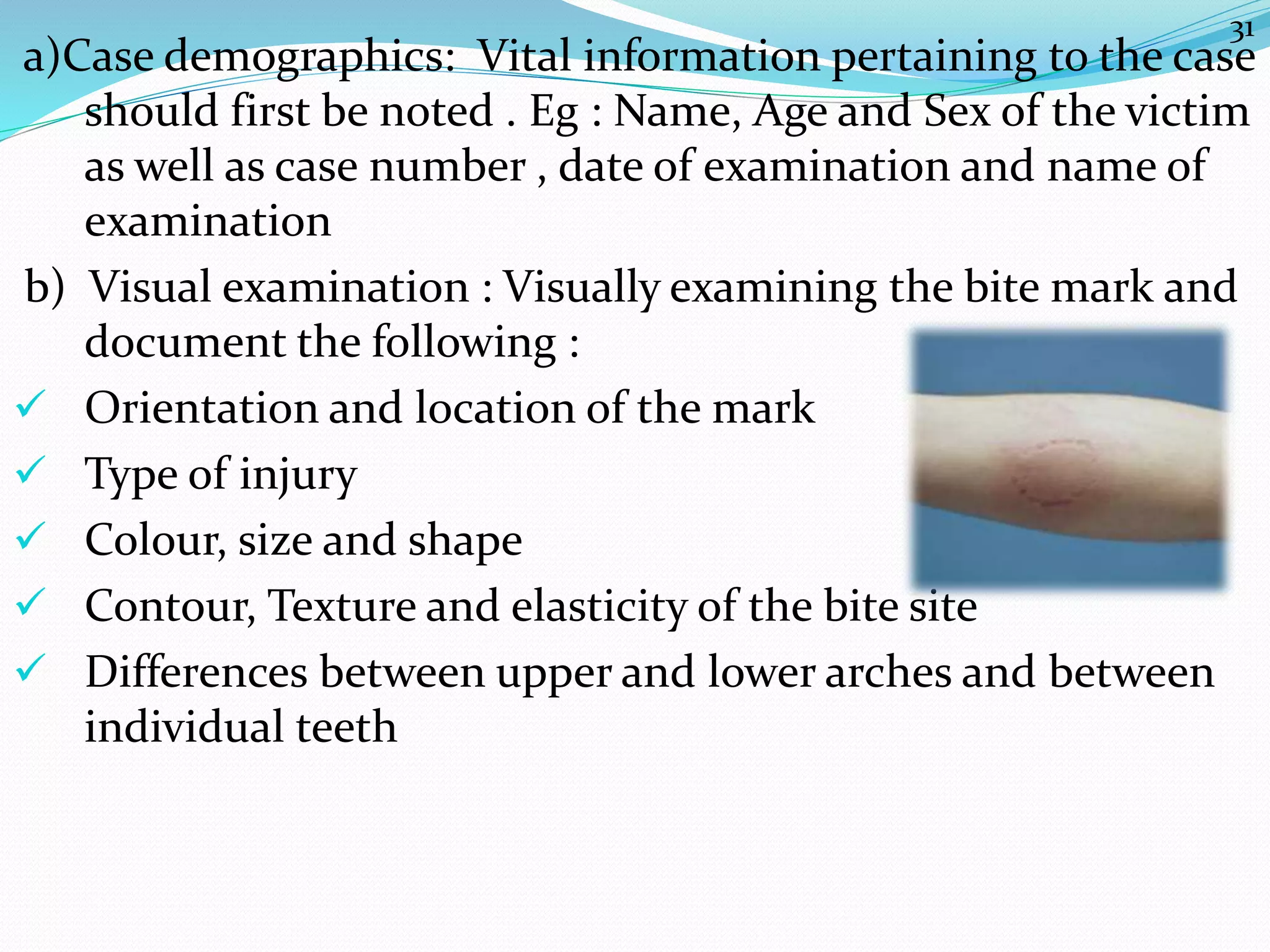 Human bite marks | PPTX