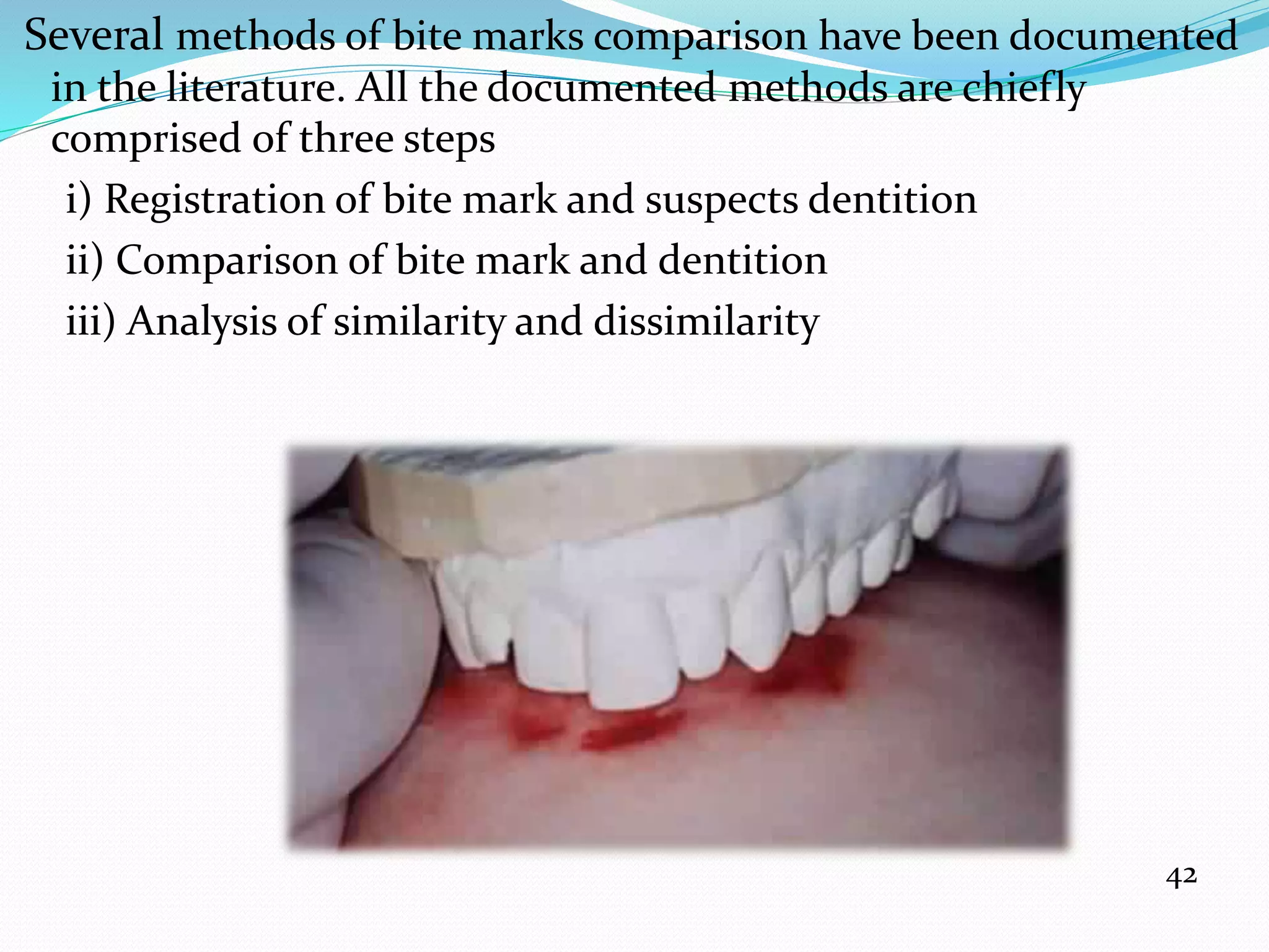 Human bite marks | PPTX