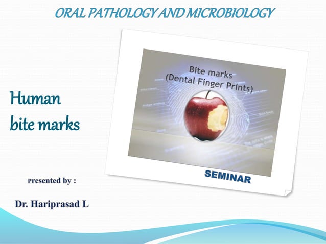 Human bite marks | PPTX | Oral care | Personal Care