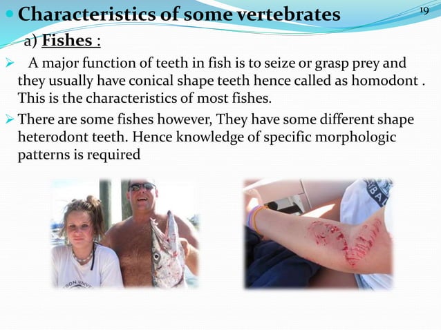 Human bite marks | PPTX | Oral care | Personal Care