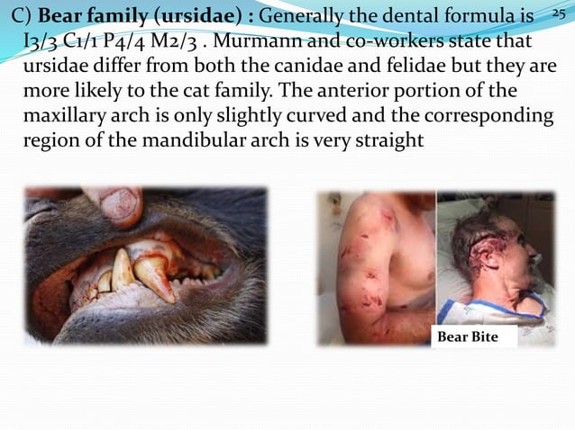 Human bite marks | PPTX | Oral care | Personal Care
