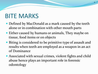 Human bite marks | PPTX