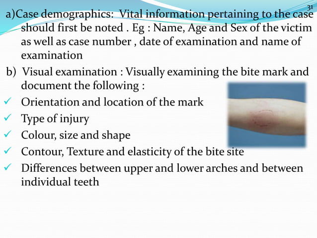 Human bite marks | PPTX | Oral care | Personal Care