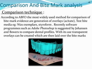 Human bite marks | PPTX