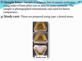Human bite marks | PPTX