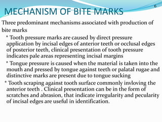 Human bite marks | PPTX