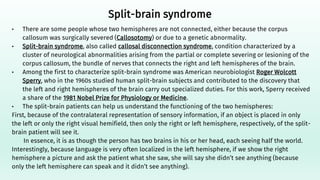 Human brain understanding the complex structure | PPTX | Brain and ...