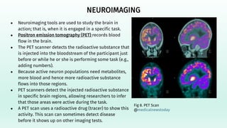 Human brain understanding the complex structure | PPTX