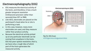 Human brain understanding the complex structure | PPTX | Brain and Nervous System Disorders ...