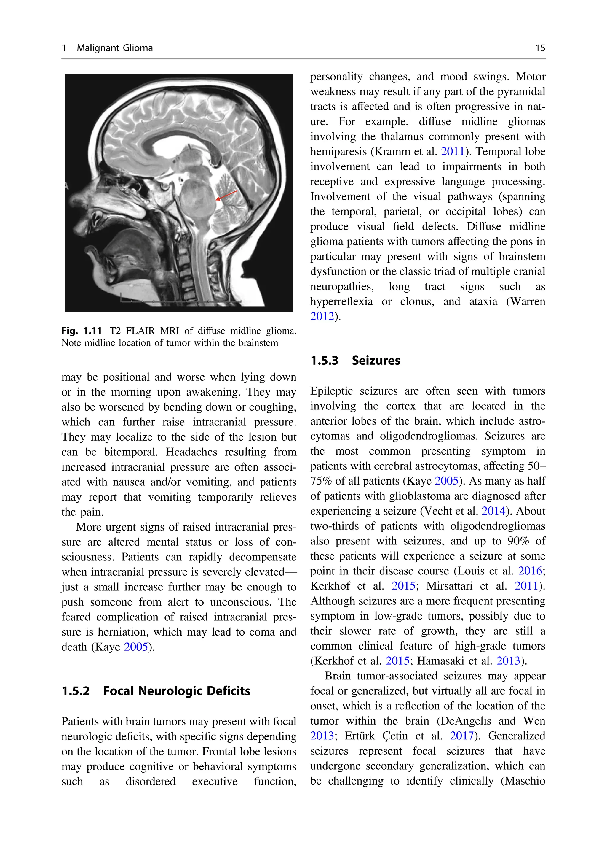 Human brain and spinal cord tumors neurology.pdf