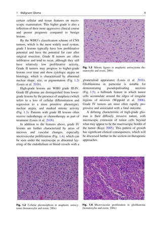 Human brain and spinal cord tumors neurology.pdf