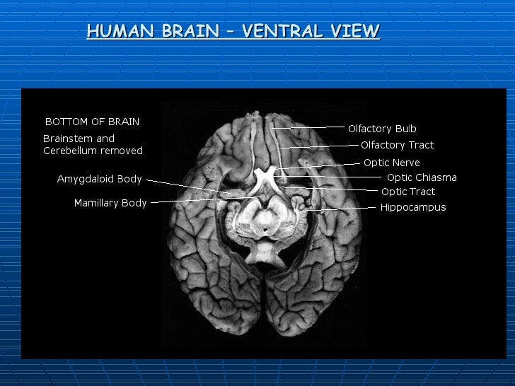 Ventral View Of The Brain