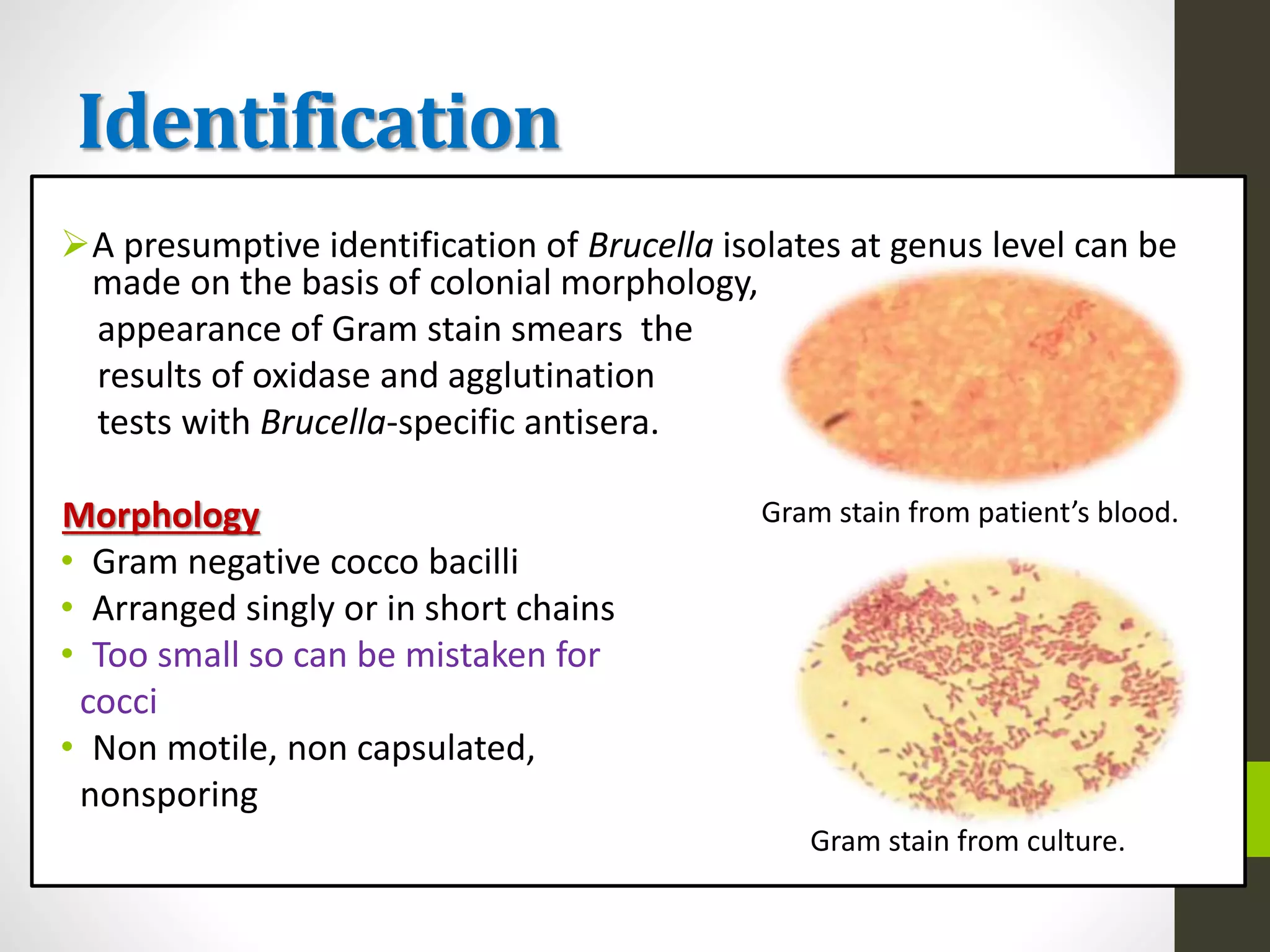 Human Brucellosis.pptx