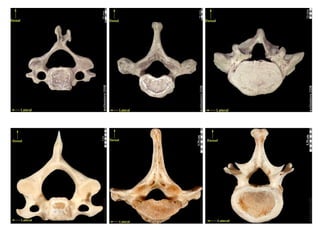 Human chimp skeleton | PPTX