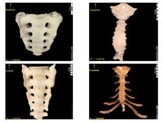 Human chimp skeleton | PPTX