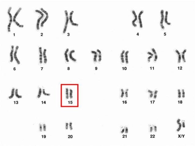 Human chromosome 15