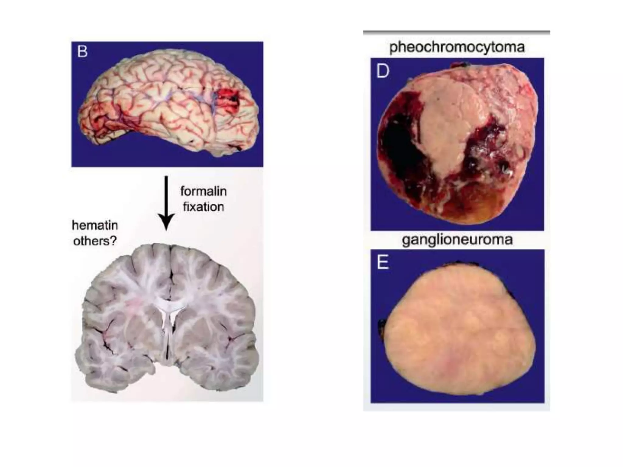 Human colors. color of normal and pathologic tissue | PPTX