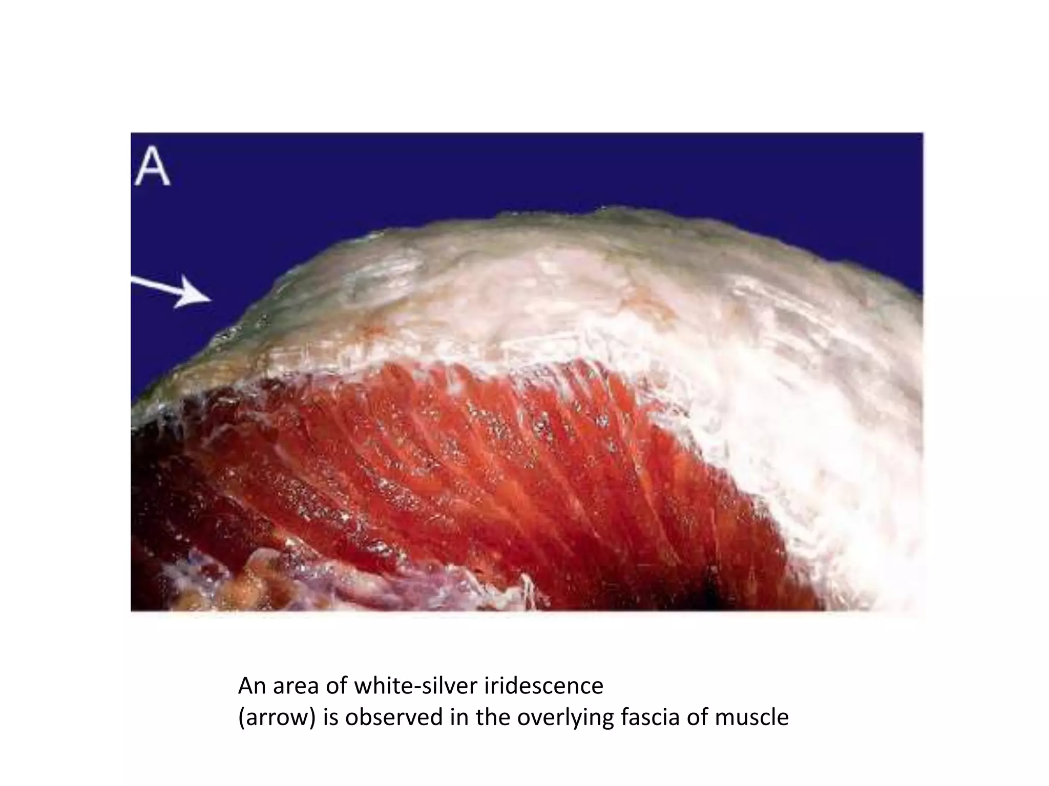Human colors. color of normal and pathologic tissue | PPTX