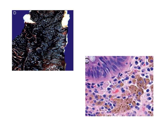Human colors. color of normal and pathologic tissue | PPTX | Blood ...