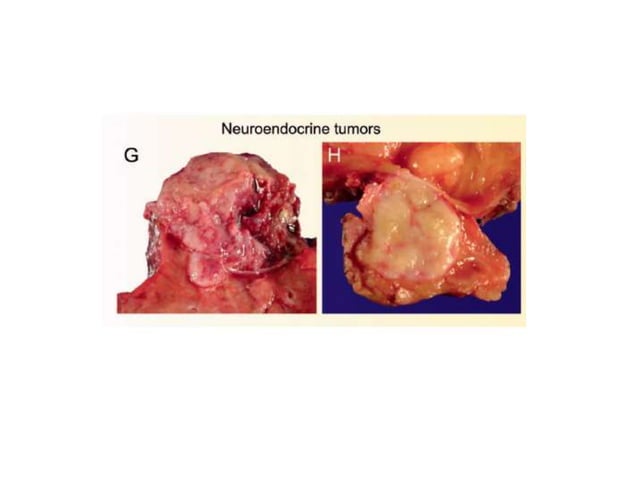 Human colors. color of normal and pathologic tissue | PPTX | Blood ...