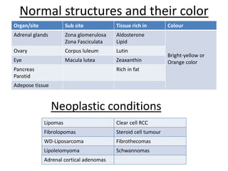 Human colors. color of normal and pathologic tissue | PPTX