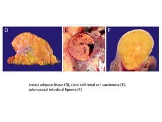 Human colors. color of normal and pathologic tissue | PPTX