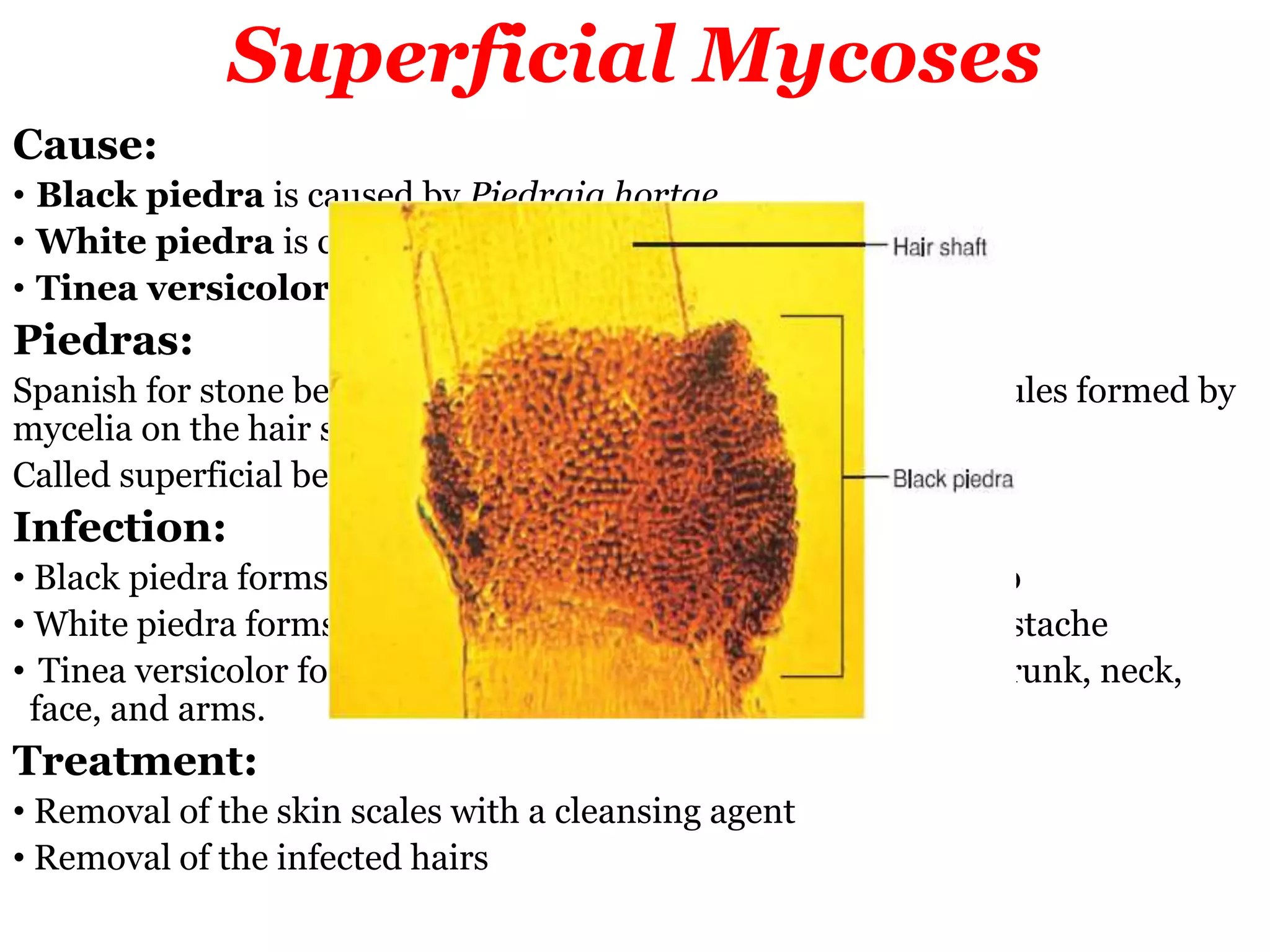 Human contact diseases | PPTX